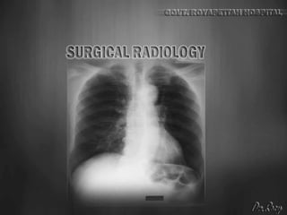 Surgery_XRays basic xray findings in general surgery mbbs.pptx
