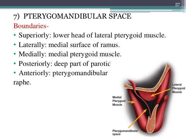 Pterygomandibular Space Boundaries Endodontic Emergencies | Pocket
