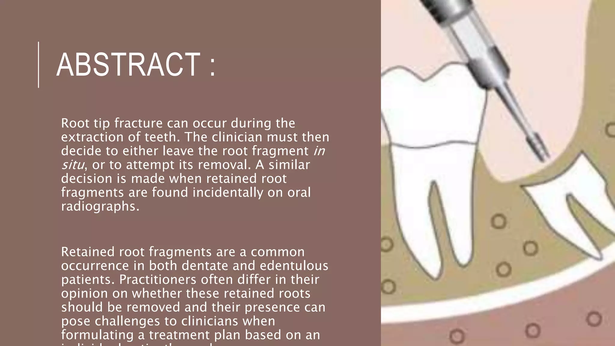 Extraction of retained roots. | PPTX
