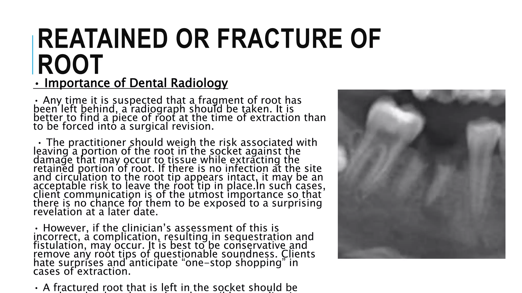 Extraction of retained roots. | PPTX