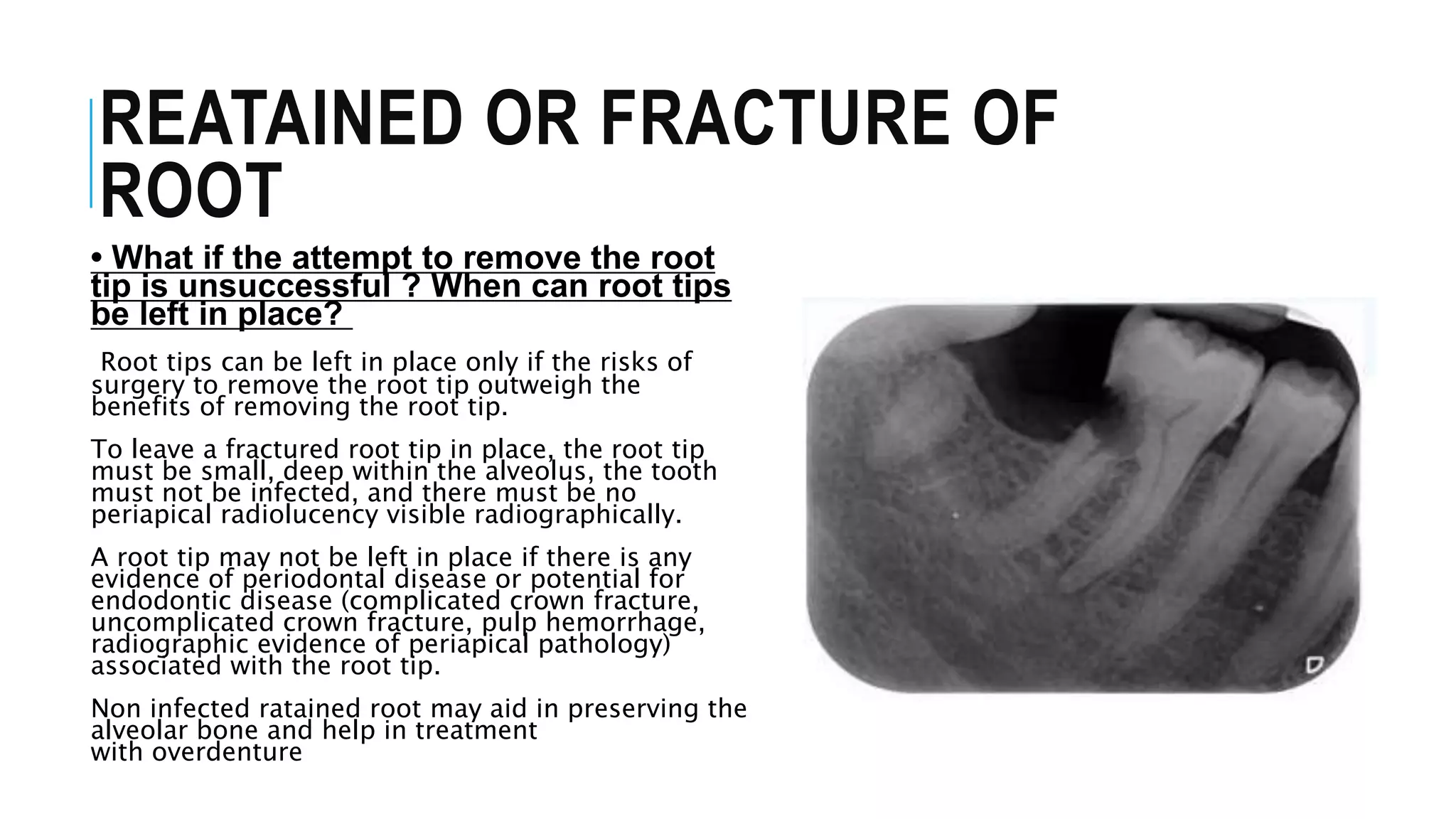Extraction of retained roots. | PPTX