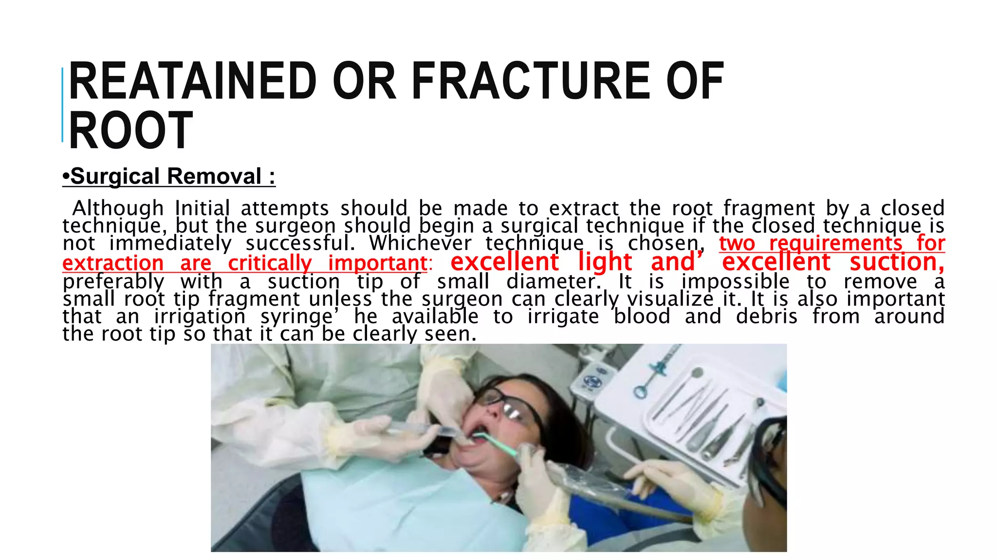 Extraction of retained roots. | PPTX