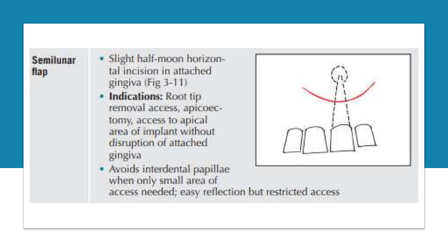 Extraction of retained roots. | PPTX