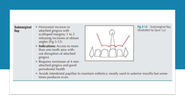 Extraction of retained roots. | PPTX