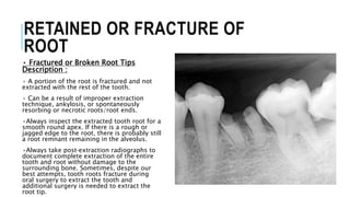 Extraction of retained roots. | PPTX