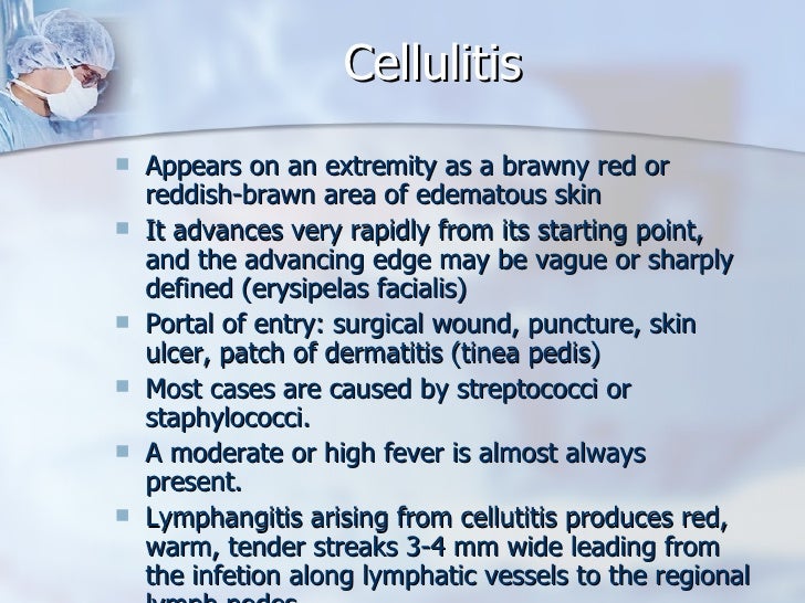 Surgical Infections Revised 2008