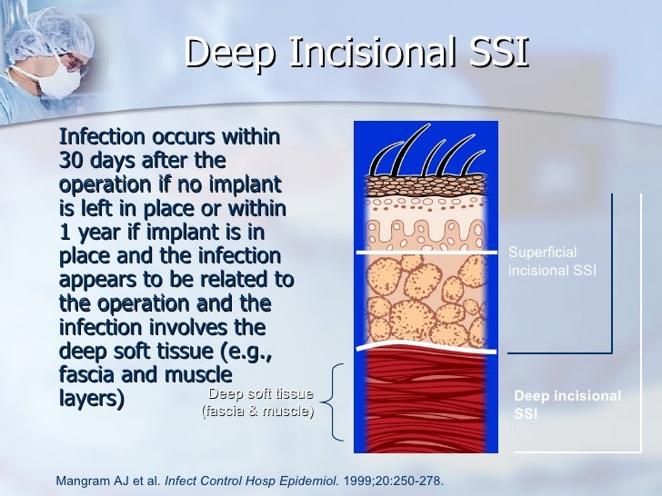 Surgical Infections Revised 2008