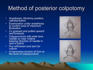 SURGICAL MANAGEMENT OF SEPTIC ABORTION | PPT