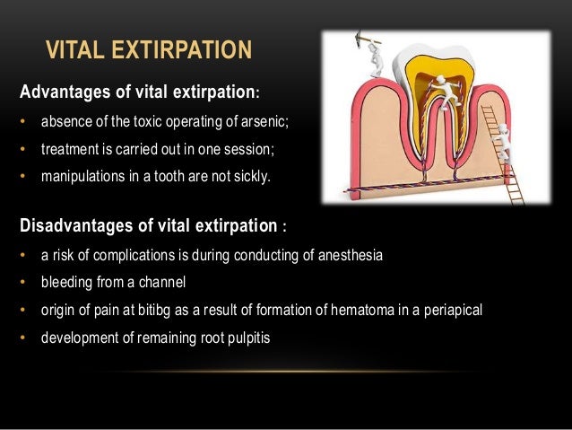 Surgical methods-treatments-of-pulpitis (Dentistry)