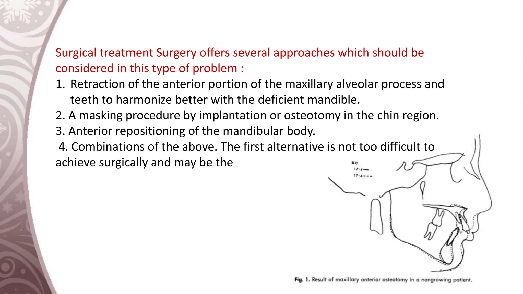 Surgical-Orthodontic Treatment of Severe Mandibular Retrusion.pptx