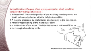 Surgical-Orthodontic Treatment of Severe Mandibular Retrusion.pptx
