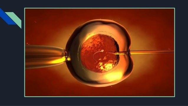 ICSI Procedure Step By Step-Fortis Fertility Centre