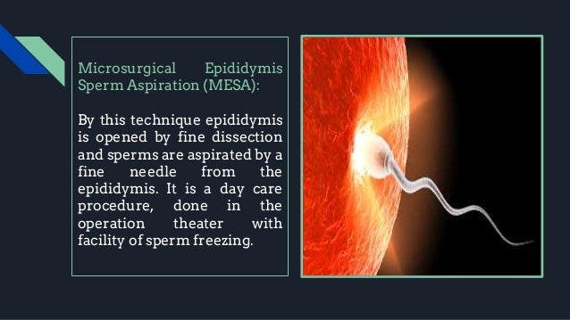 ICSI Procedure Step By Step-Fortis Fertility Centre