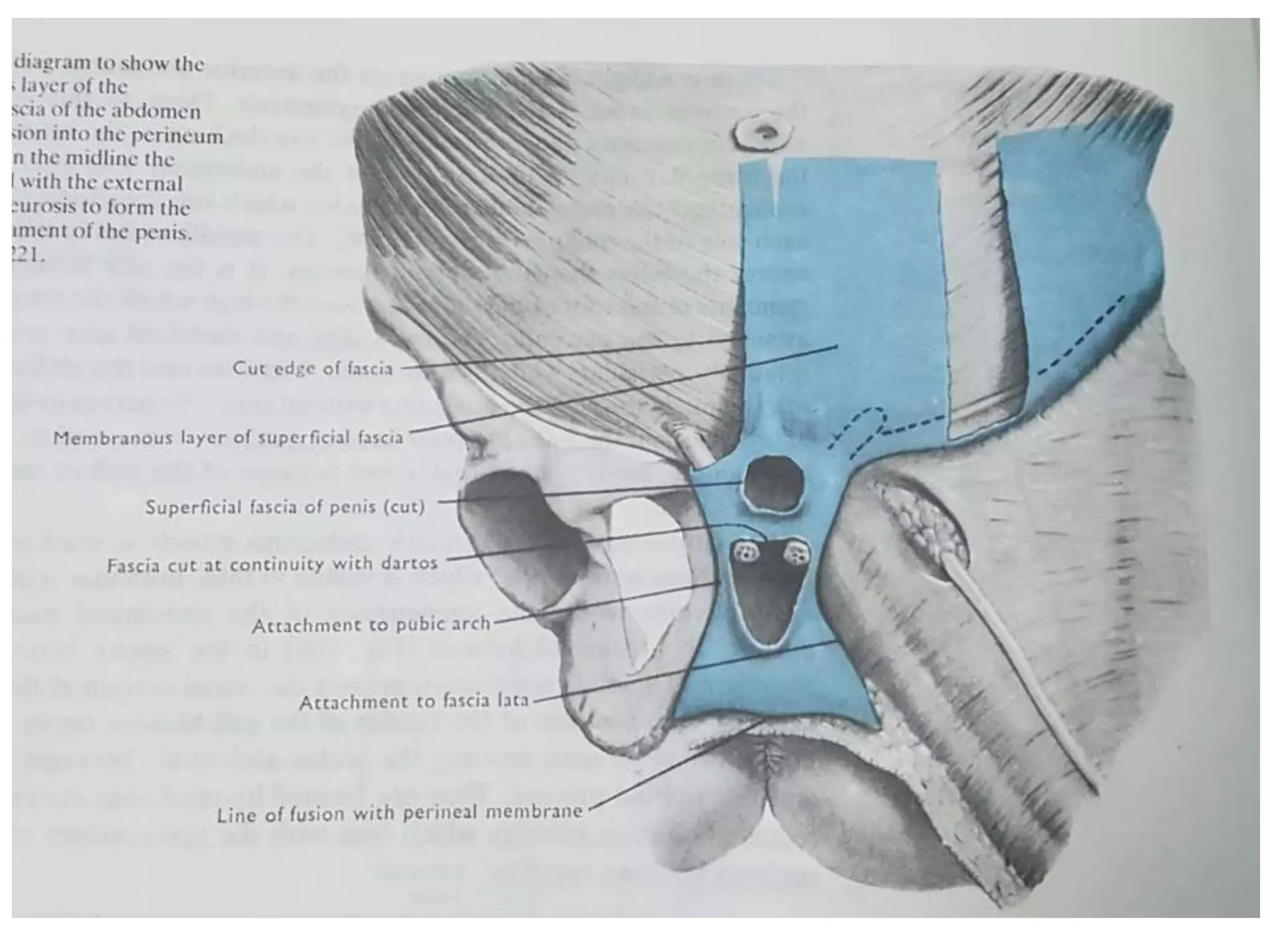 Surgical anatomy of inguinal canal | PPTX