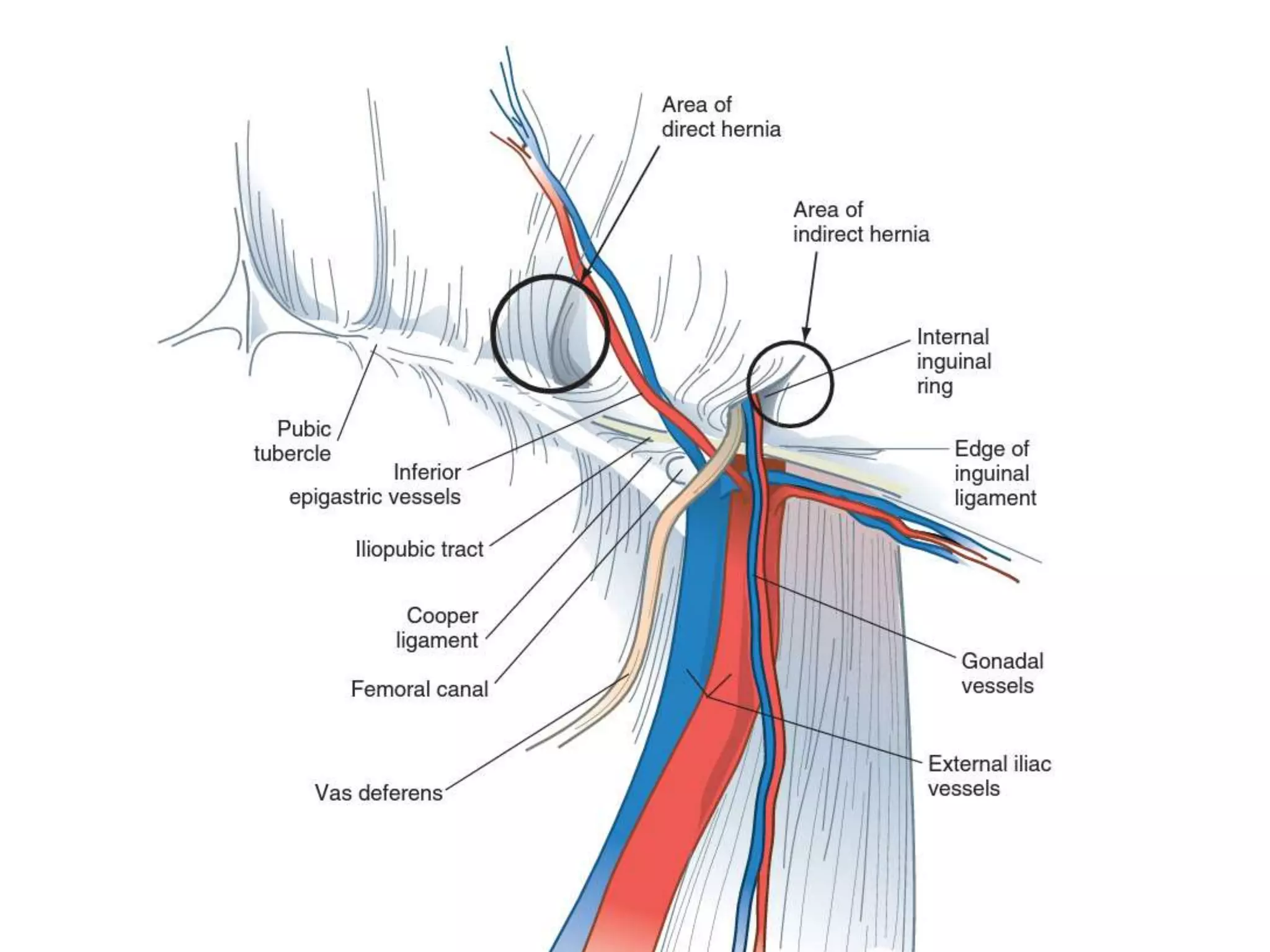 Surgical anatomy of inguinal canal | PPTX
