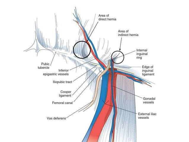 Surgical anatomy of inguinal canal | PPTX