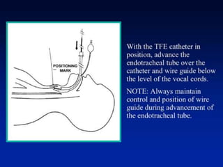 Surgical airway technique | PPT
