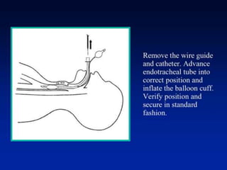 Surgical airway technique | PPT