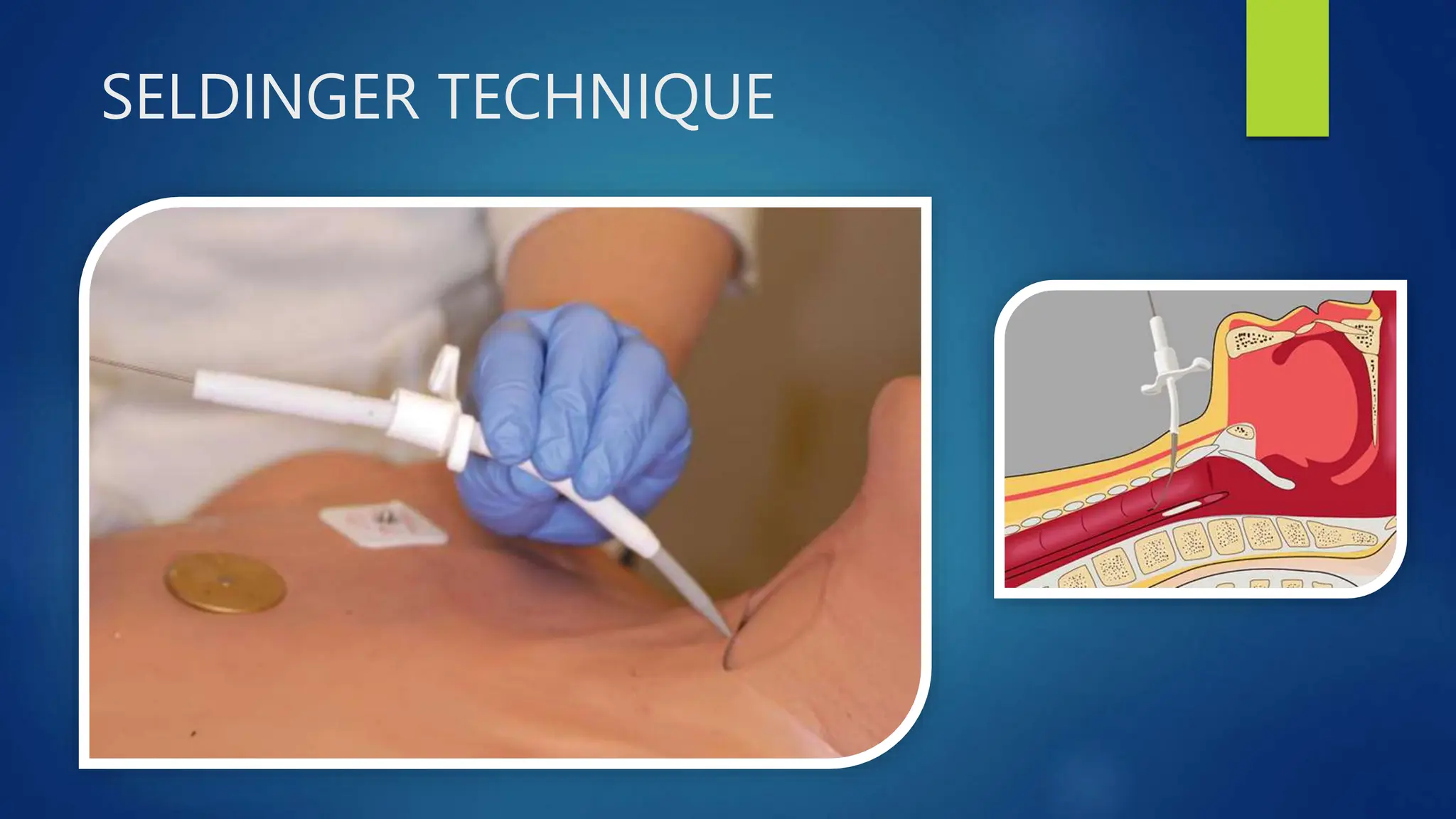 Surgicalairwayand cricothyroidotomy.pptx