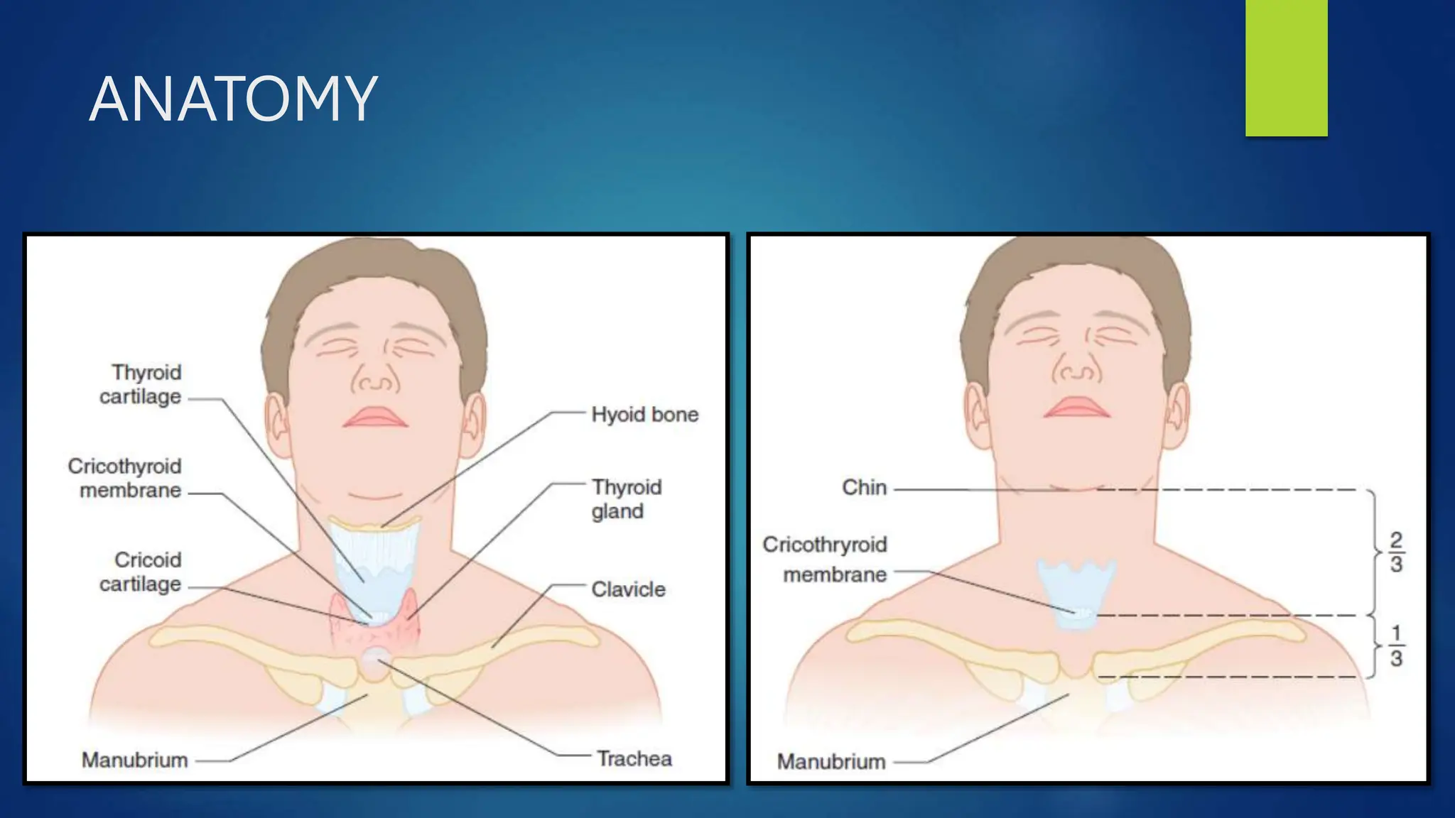 Surgicalairwayand cricothyroidotomy.pptx