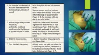Surgicalairwayand cricothyroidotomy.pptx