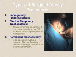 Surgical airway procedures | PPT
