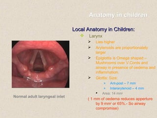 Surgical airway procedures | PPT