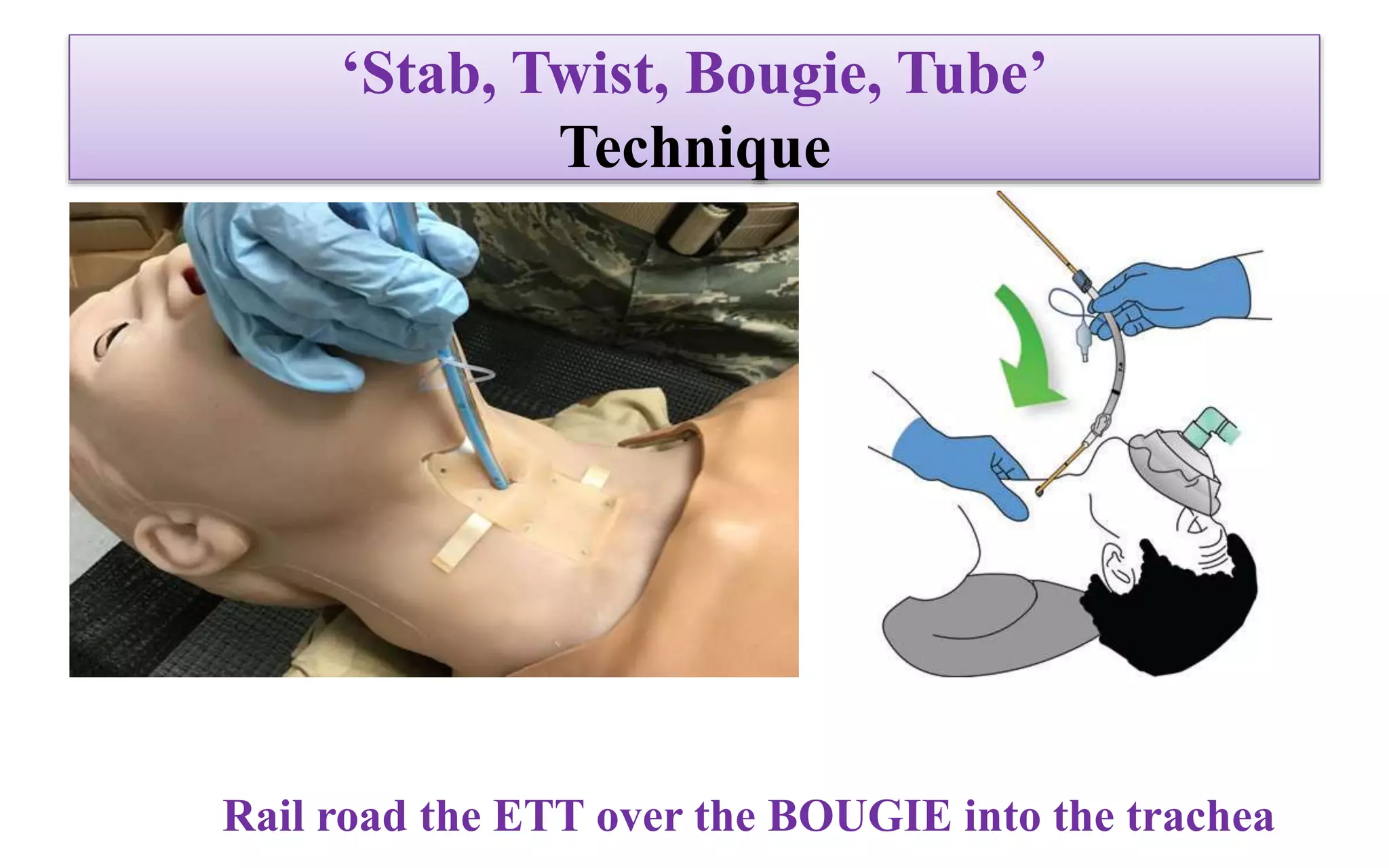Surgical airway techniques | PPTX | Lung and Respiratory Health ...