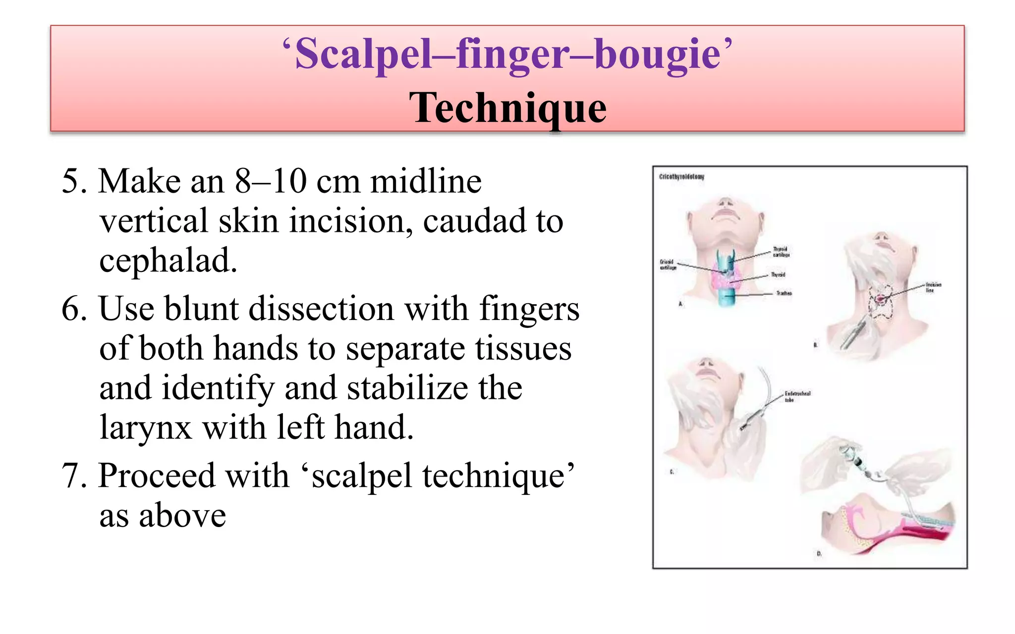 Surgical airway techniques | PPTX