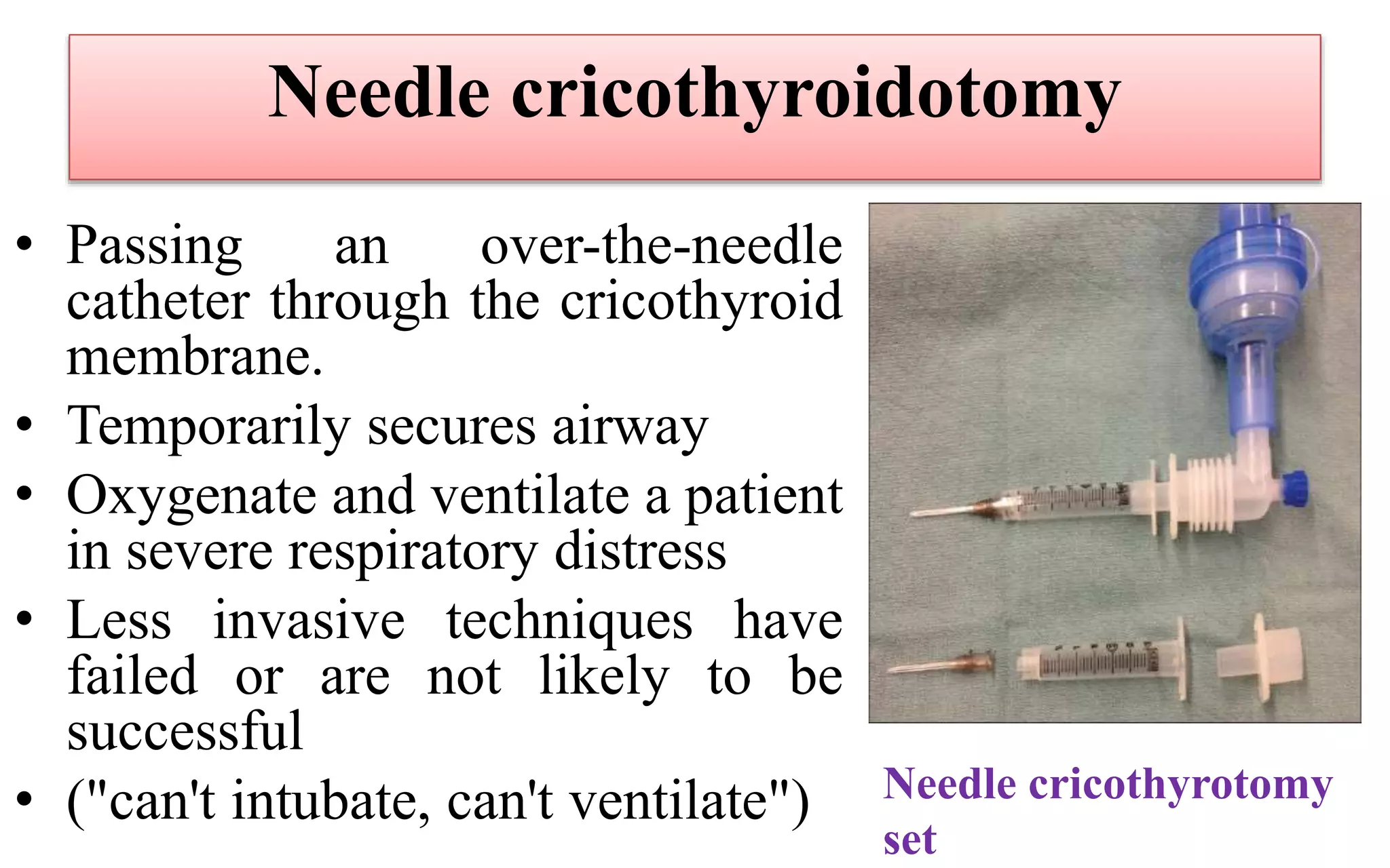 Surgical airway techniques | PPTX