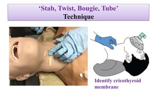 Surgical airway techniques | PPTX