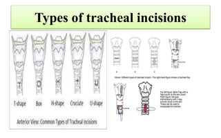 Surgical airway techniques | PPTX