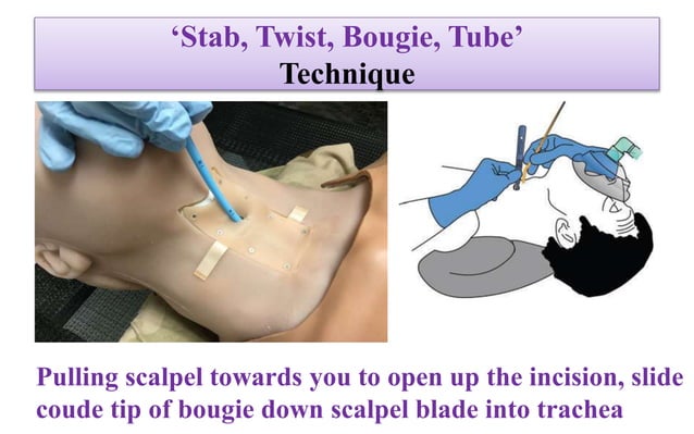Surgical airway techniques | PPT