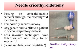 Needle Cricothyroidotomy Kit