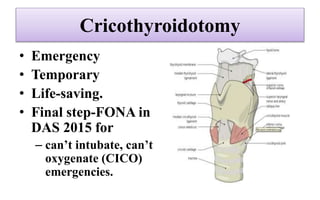 Cricothyroidotomy Anatomy