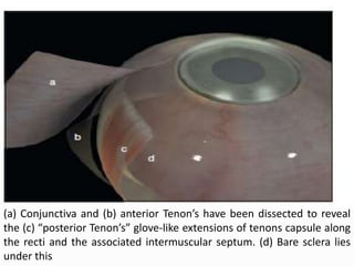 Surgical anatomy of the retina | PPTX