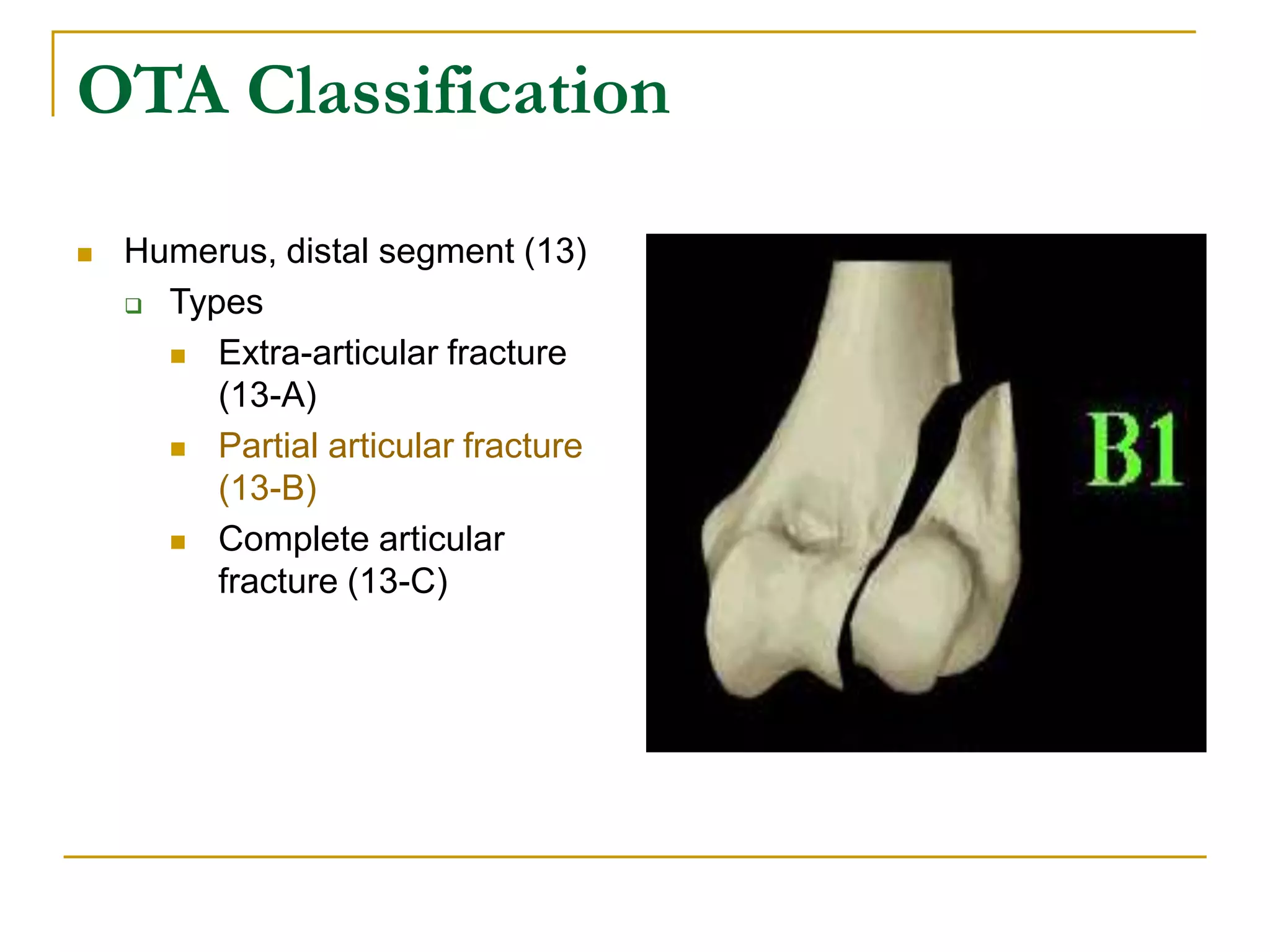 Anatomy Of Elbow And Fractures Around Elbow And Surgical Options In Adults Ppt