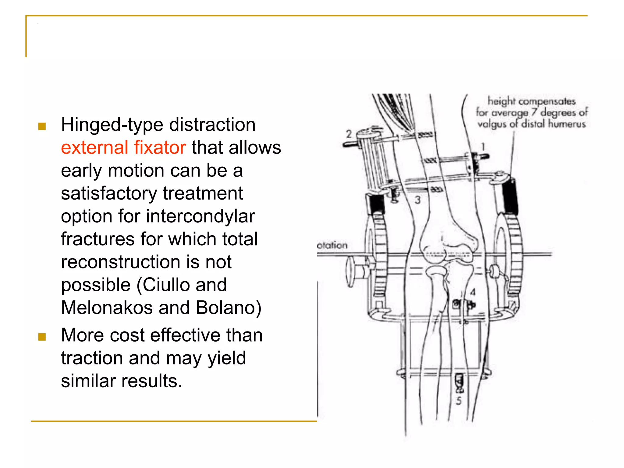 anatomy of elbow & fractures around elbow & surgical options in adults ...