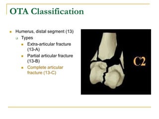 anatomy of elbow & fractures around elbow & surgical options in adults ...