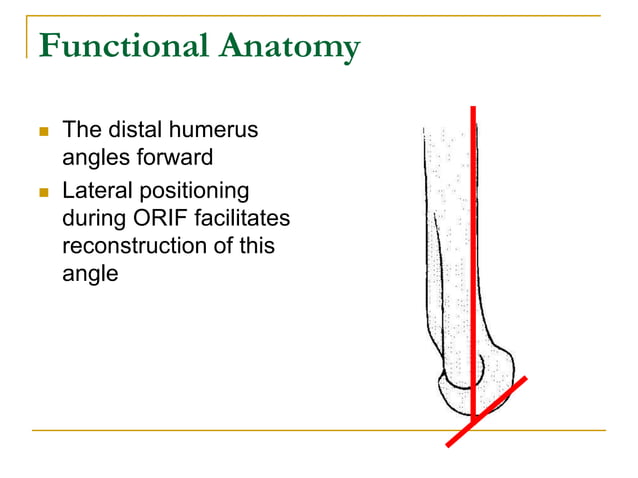 anatomy of elbow & fractures around elbow & surgical options in adults ...