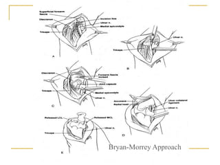 anatomy of elbow & fractures around elbow & surgical options in adults ...