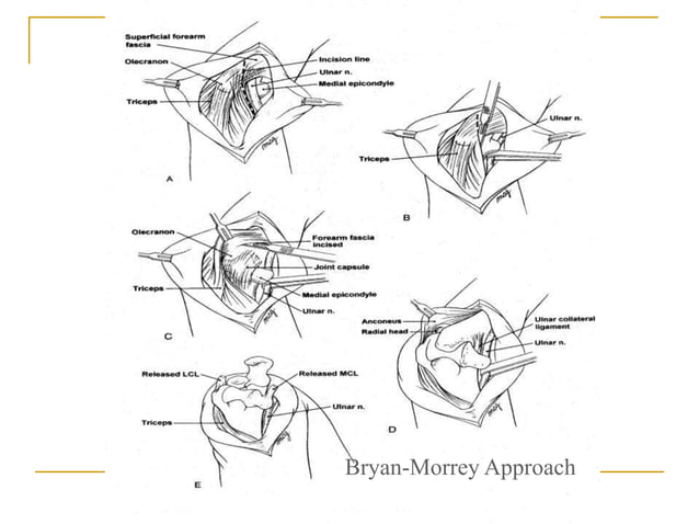 Anatomy Of Elbow And Fractures Around Elbow And Surgical Options In Adults Ppt