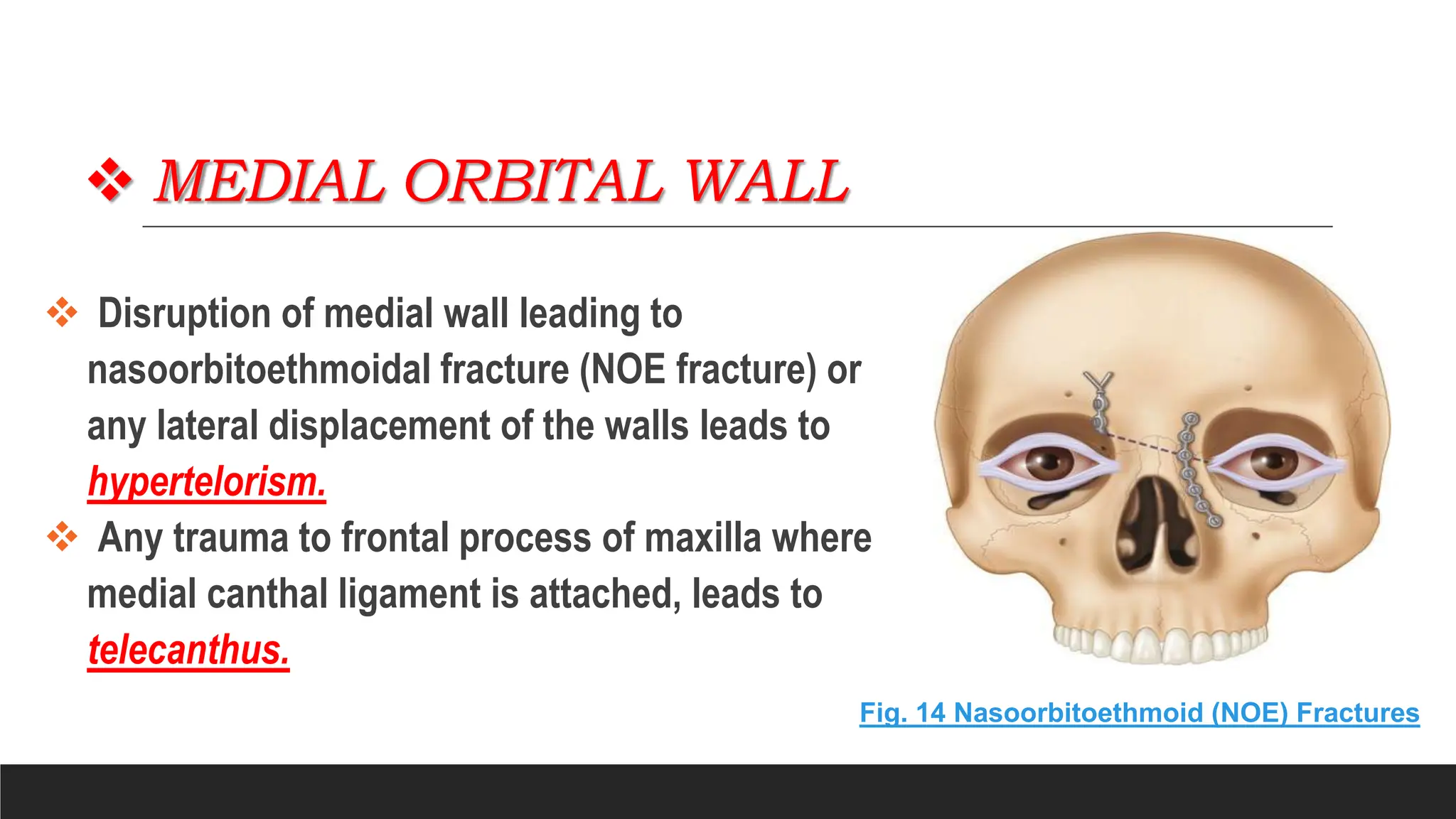 Surgical Anatomy For Orbital Procedures .pptx