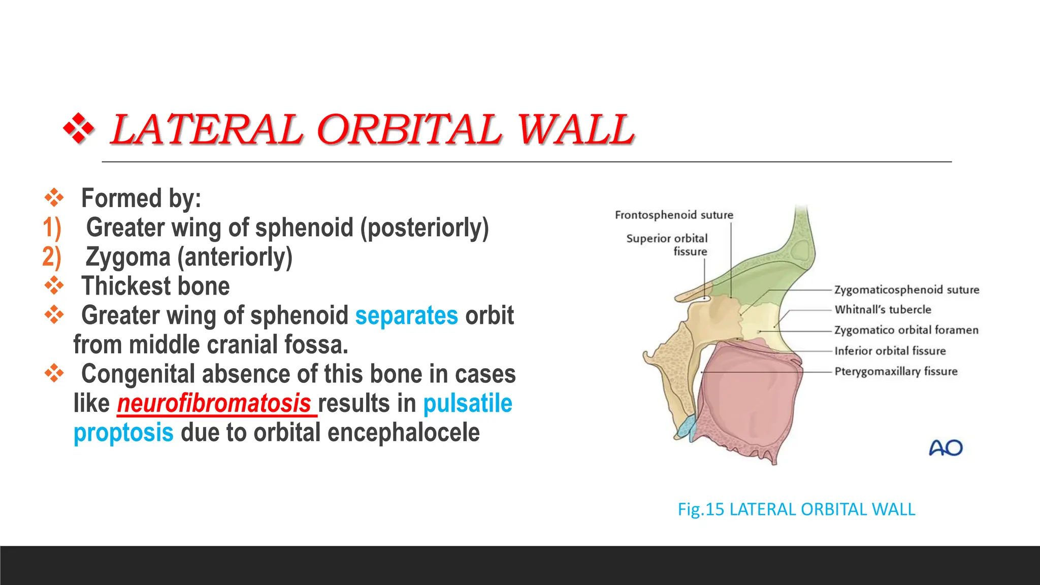 Surgical Anatomy For Orbital Procedures .pptx