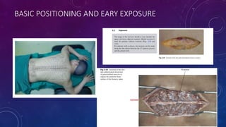 Surgical Anatomy for Thoracic Spine Lesion VM.pptx