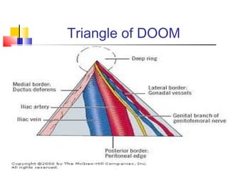 Surgical anatomy inguinal canal dr mnr | PPT