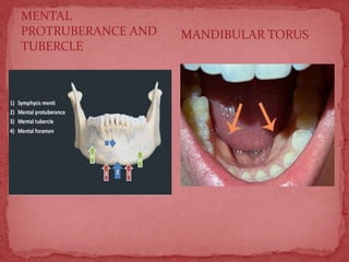 Surgical anatomy in periodontics | PPTX