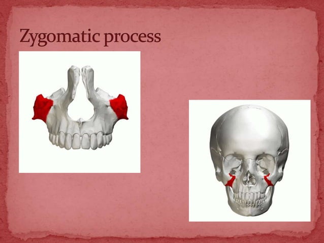 Surgical anatomy in periodontics | PPTX | Dental Health | Diseases and ...
