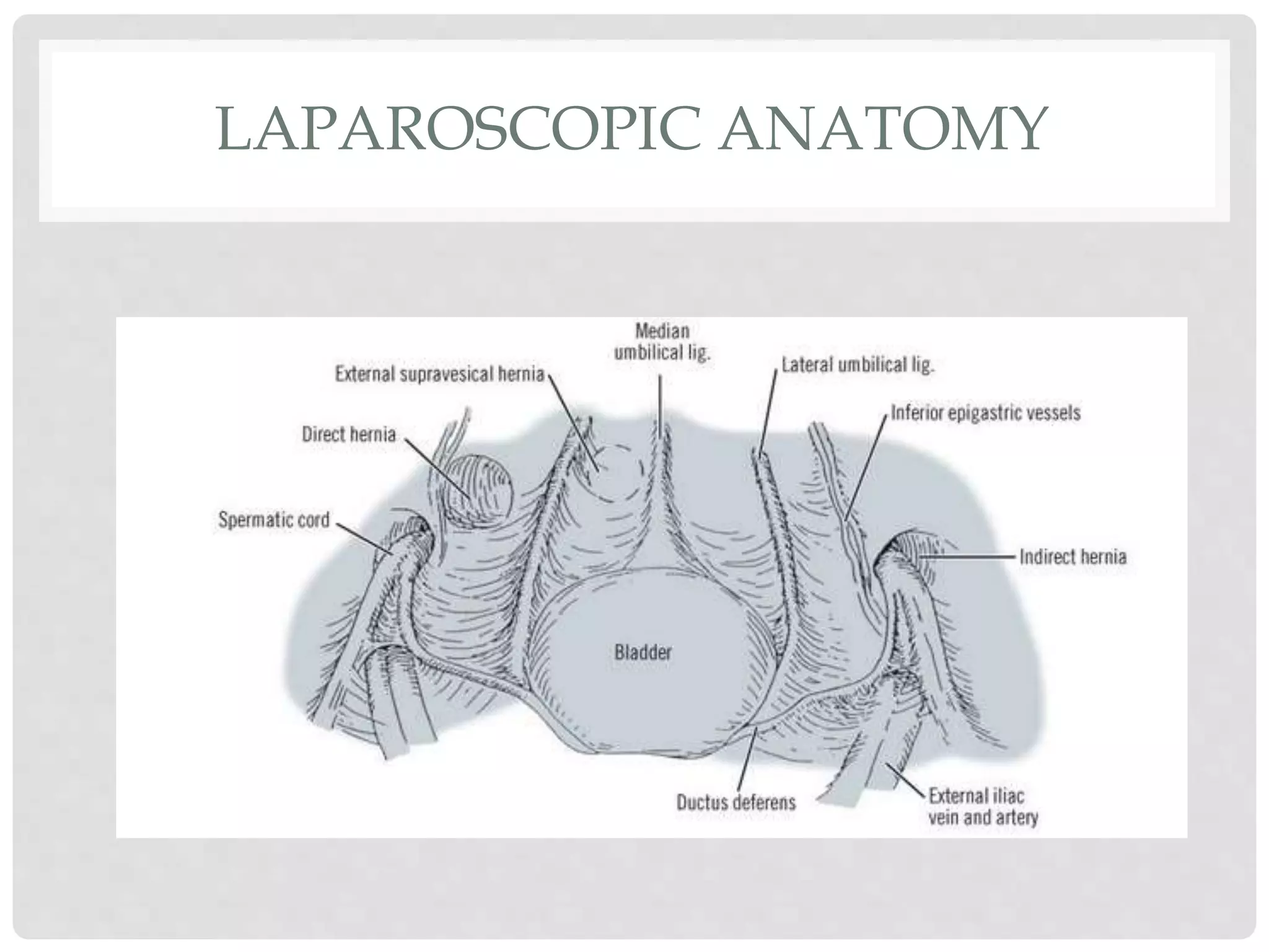 Surgical anatomy of abdomen | PPTX