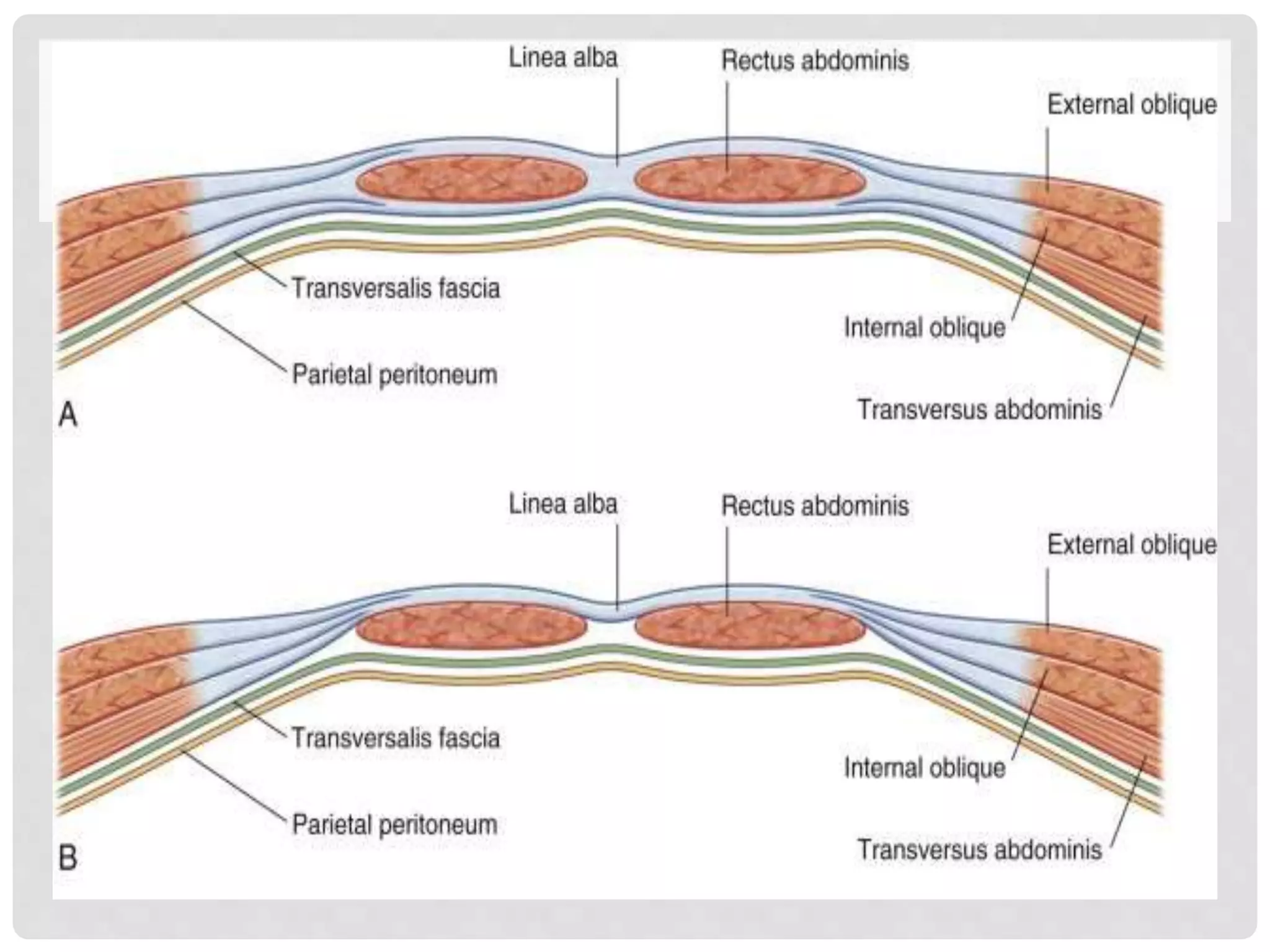Surgical anatomy of abdomen | PPTX